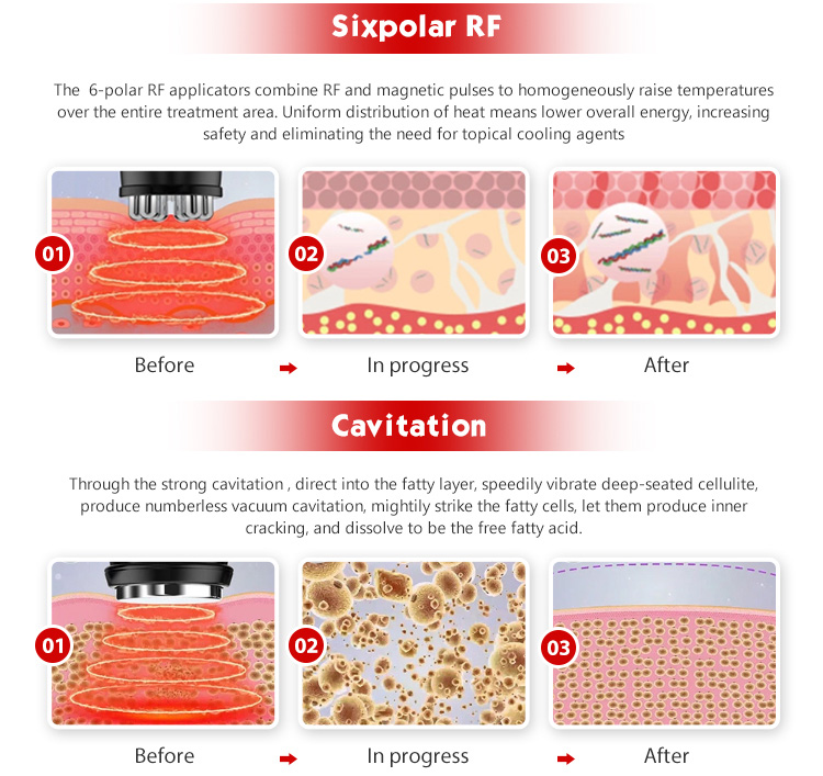Ultrasonic Radio Frequency Laser Fat Removal Machine from China Manufacturer - Beauty machine ...