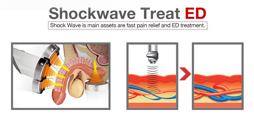 ED function extracorporeal shock wave therapy machine for sale